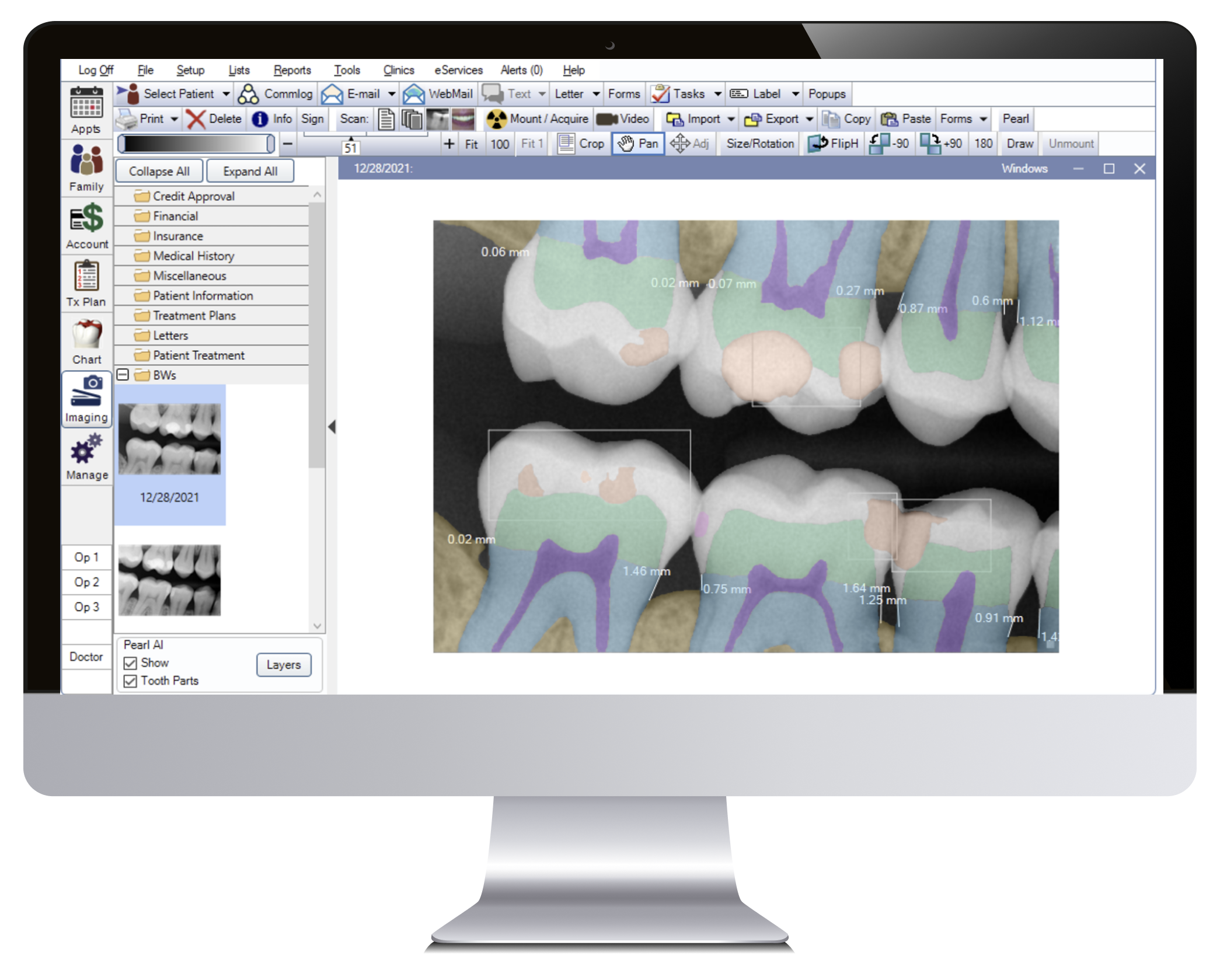 Pearl | AI for Open Dental | Request a Pearl demo!