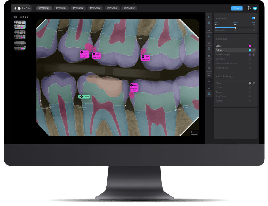 Download - The future of dentistry, powered by AI